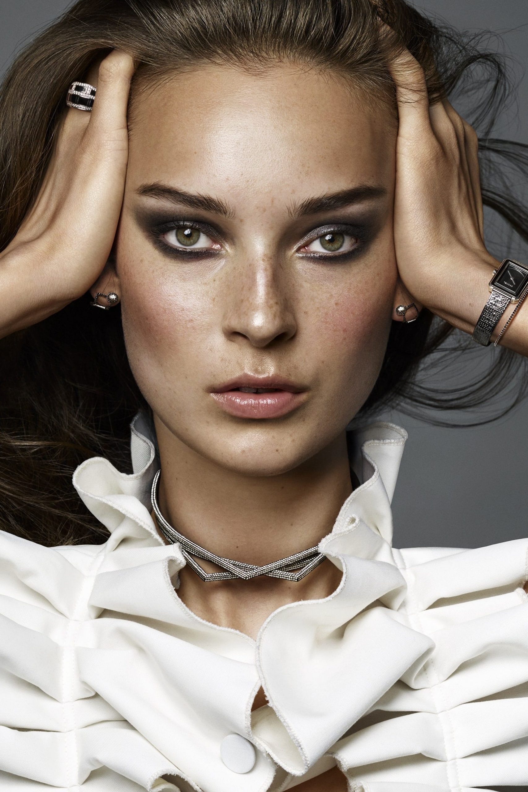 Facial threads in Paris 7 | Aesthetic face medicine | Dr Guzman